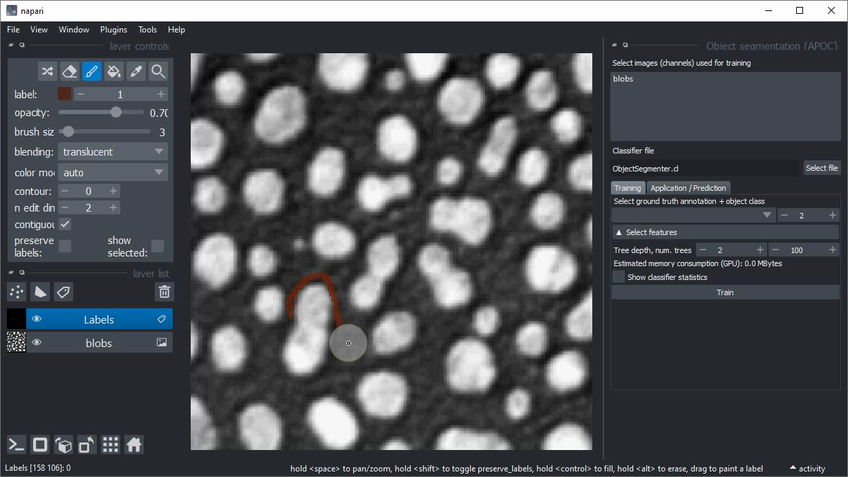 Clasificación interactiva de píxeles y segmentación de objetos en Napari — Bio-image Analysis ...