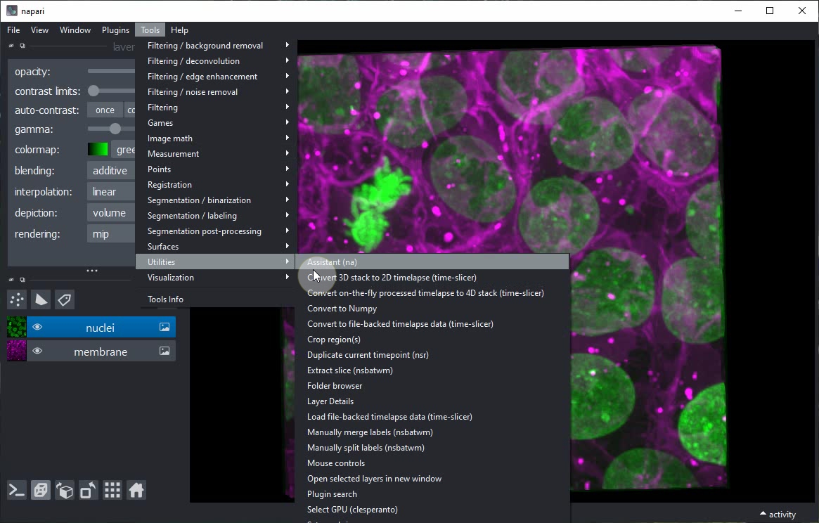 El Asistente de Napari — Bio-image Analysis Notebooks