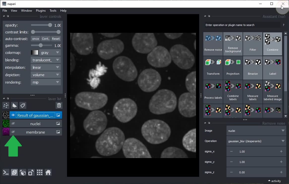 El Asistente de Napari — Bio-image Analysis Notebooks