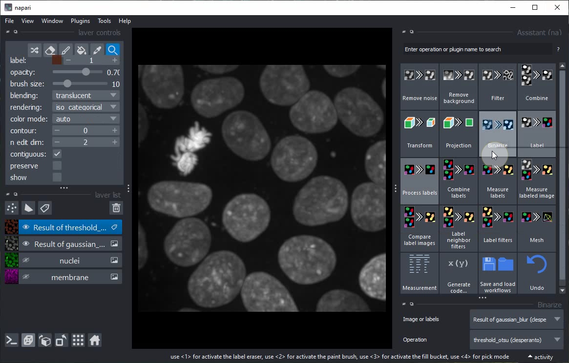 El Asistente de Napari — Bio-image Analysis Notebooks
