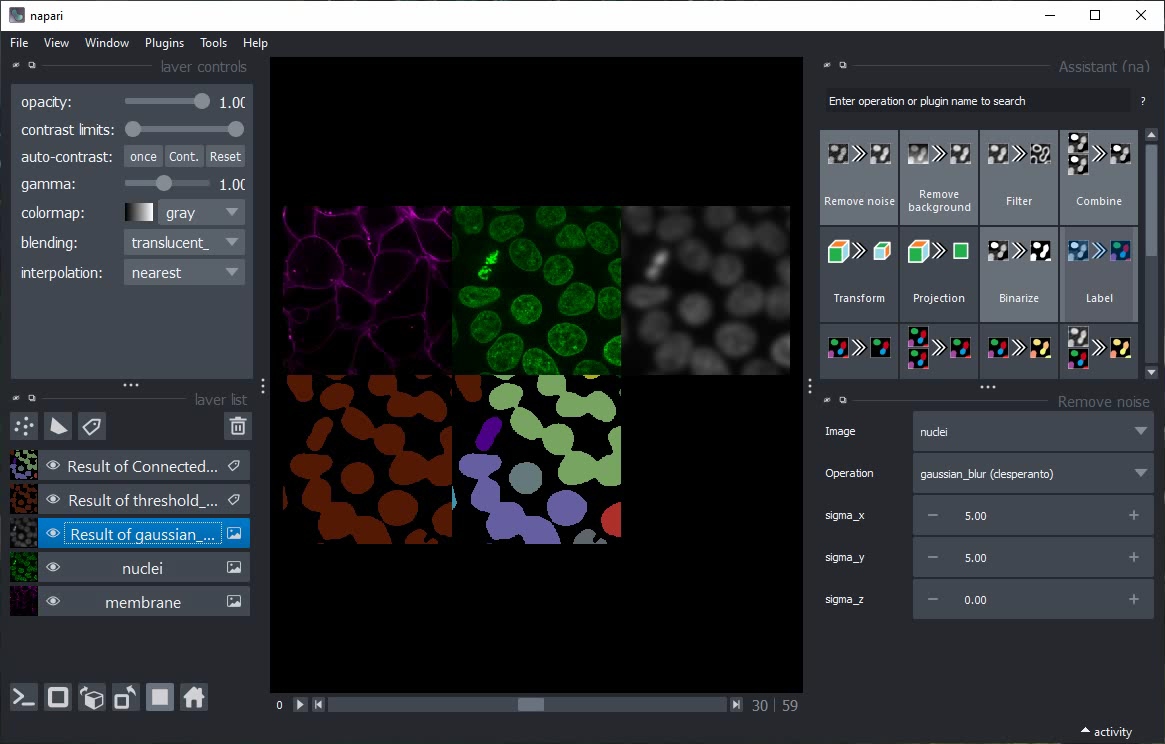 El Asistente de Napari — Bio-image Analysis Notebooks