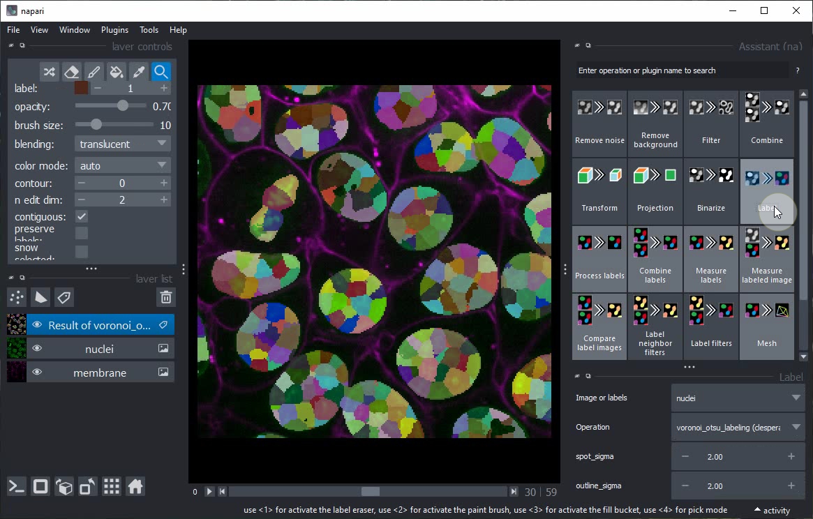 El Asistente de Napari — Bio-image Analysis Notebooks